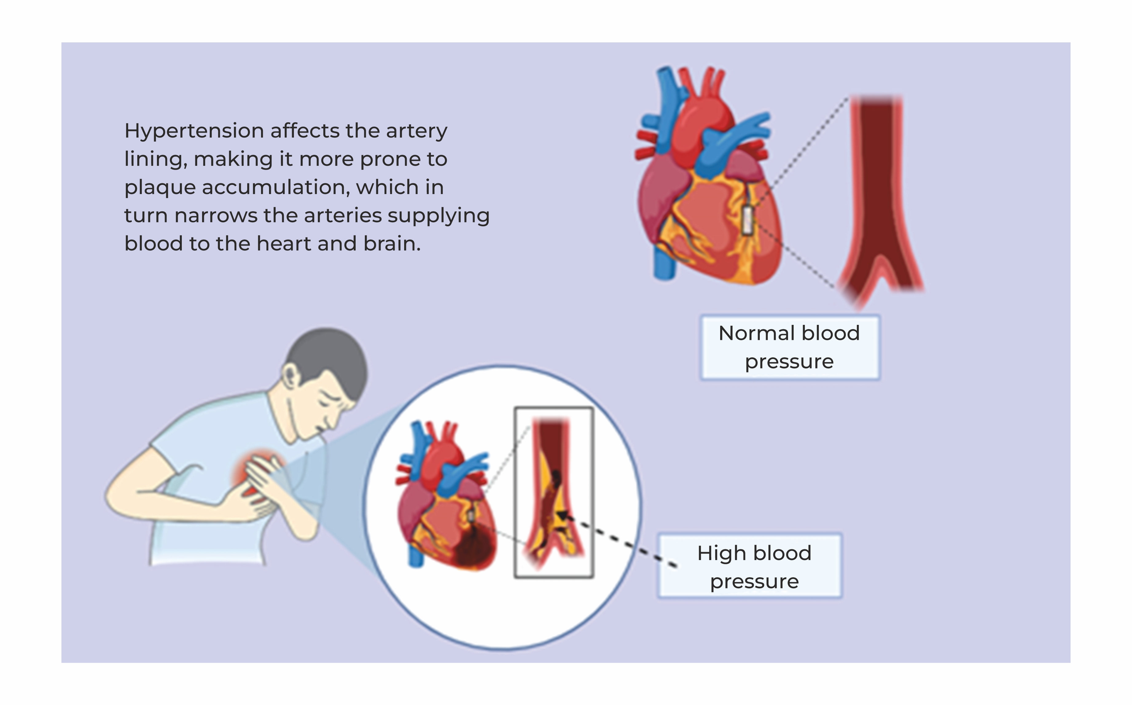 Mission Organ Protection | An Initiative by Micro Labs Limited